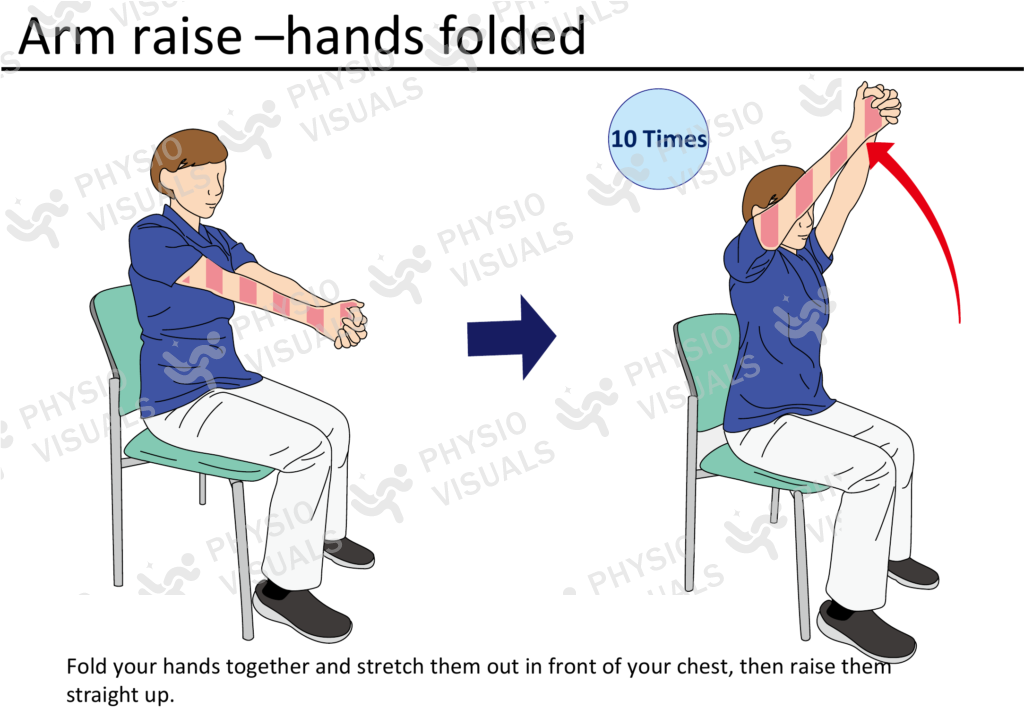 Arm Raise –Hands Folded | Physio Visuals: Illustrated Exercise ...