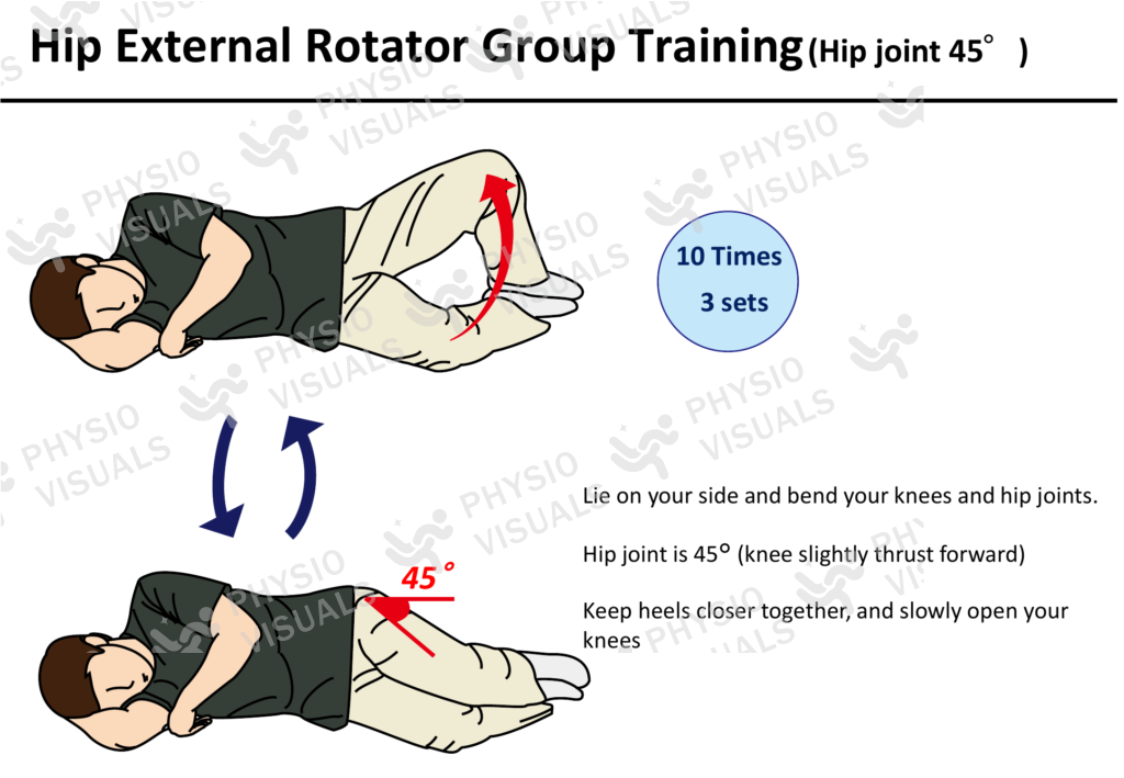 Hip External Rotator Group Training (Hip joint 45°) | Physio Visuals ...